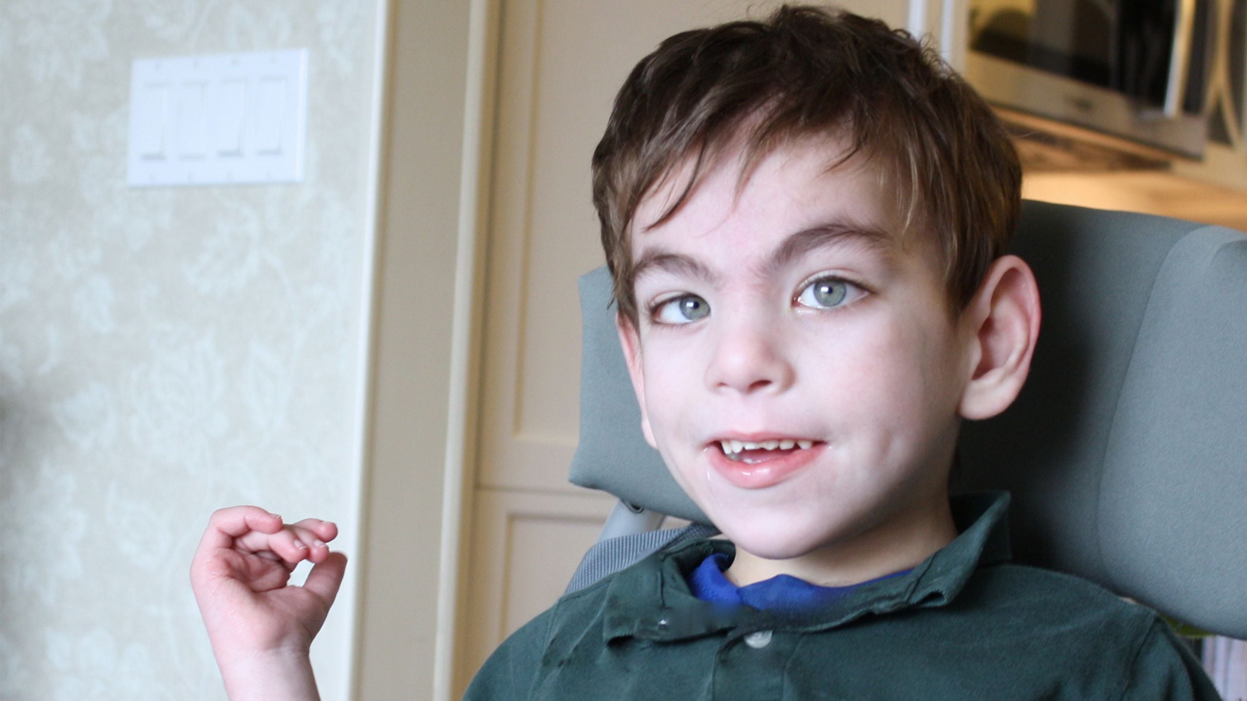 Microcephalic Children Facts About Microcephaly Parents Magazine