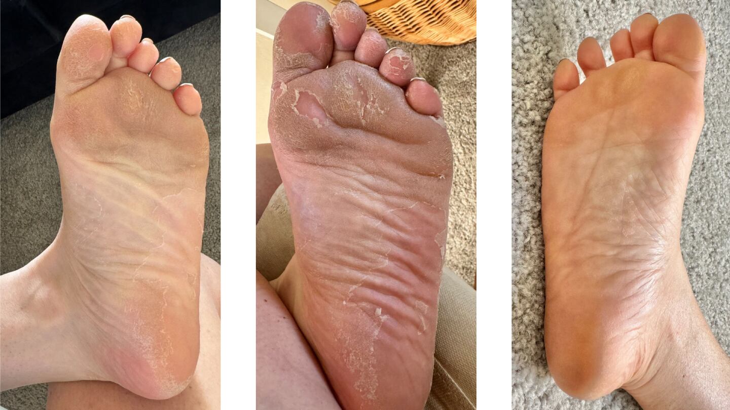 StackedSkincare Foot Peel Before and After Review
