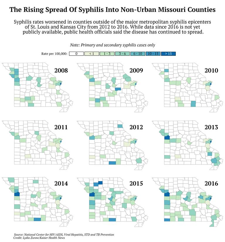 Syphilis Is Spreading Across Rural America