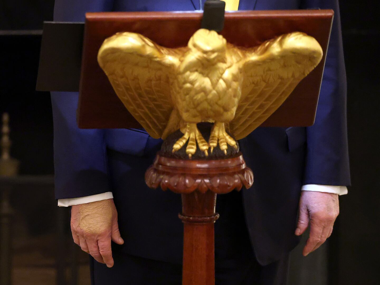 Trump’s Hideously Bruised Hand Makes Appearance at White House Dinner