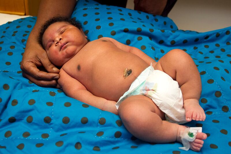 World’s Biggest Babies: The 16-pound Baby in Texas and Other Giant Newborns