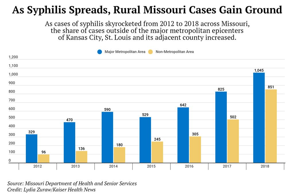 Syphilis Is Spreading Across Rural America