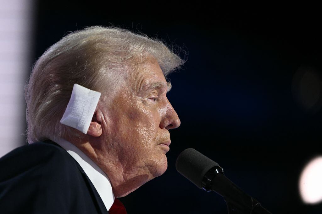 Donald Trump Ditches His White Ear Bandage for a Less Flashy Update