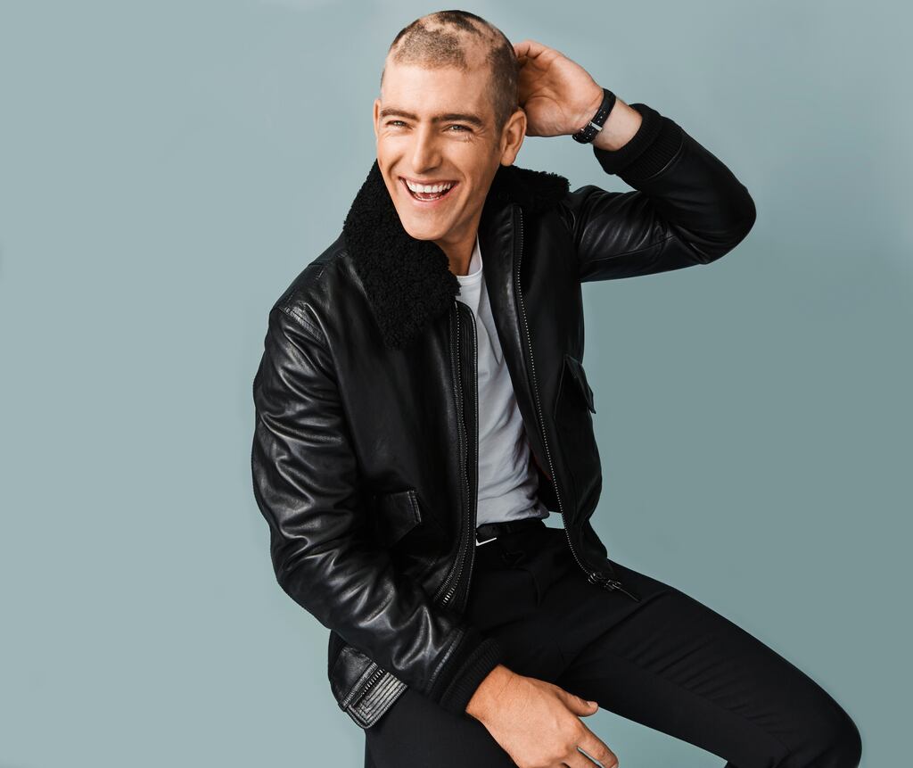 This Male Model Who Lost His Hair Is Giving Men Hope & Confidence