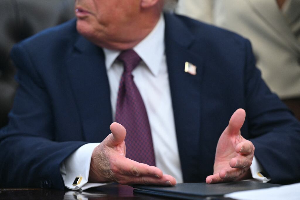 Trump, 79, Avoids Showing Makeup-Covered Hand in Oval Office