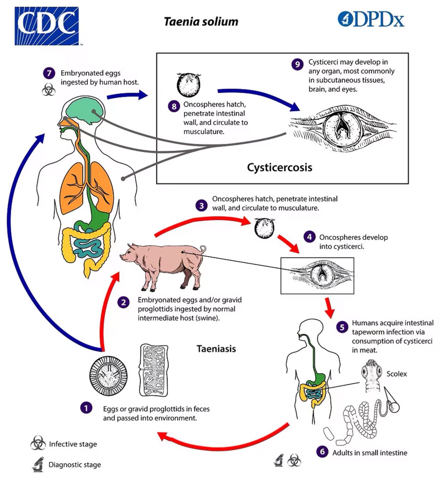 RFK JR.’s Brain Worm—How to Know If You Have a Similar Parasite in Your ...