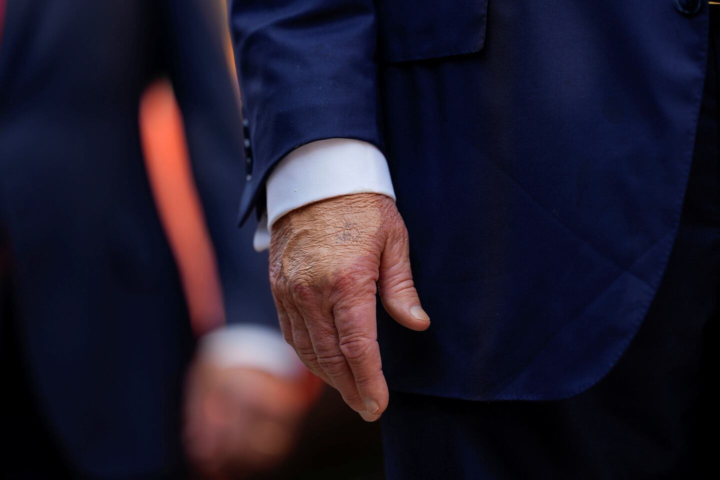 Donald Trump Spotted Wearing Four Band-Aids During Golf Trip in Scotland