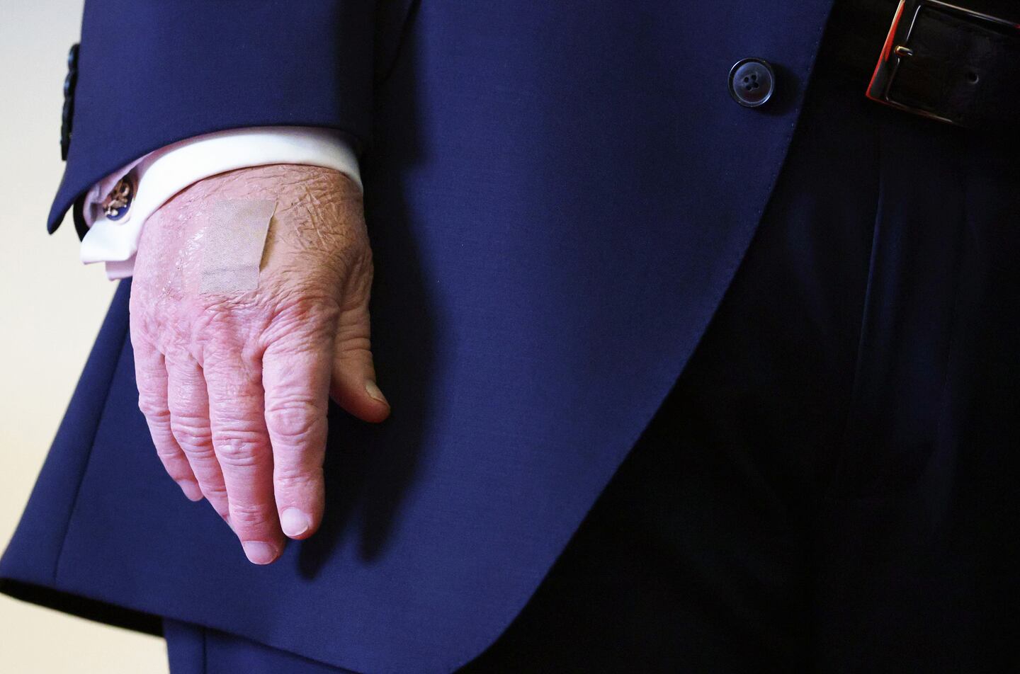Trump’s Now Been Covering His Hand With a Bandage for a Full Week
