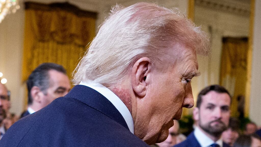 Doctor Says Donald Trump’s Golf Habit May Be Reason for Mysterious Neck ...