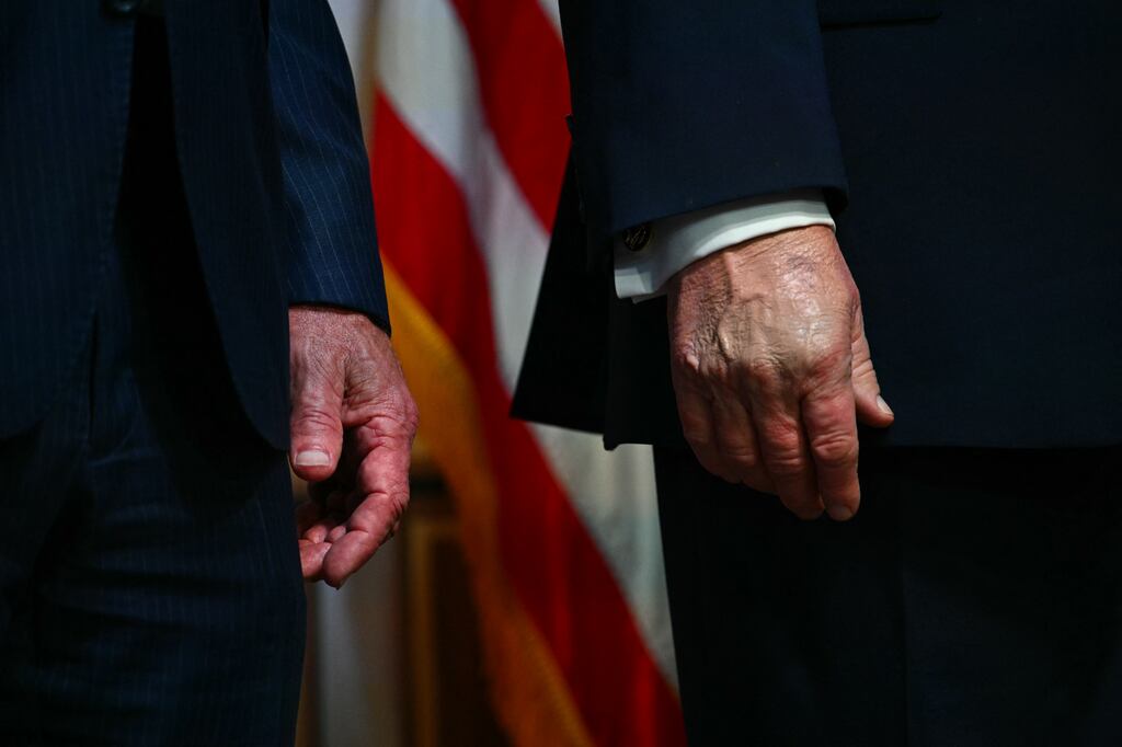 MAGA Goon Robert F. Kennedy Jr., 72, Debuts Gnarly Hand Alongside ...