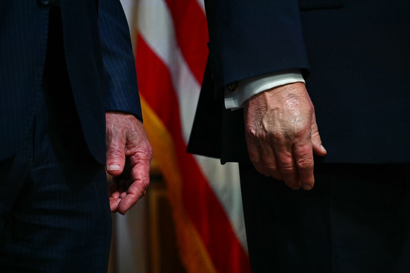 MAGA Goon Robert F. Kennedy Jr., 72, Debuts Gnarly Hand Alongside ...