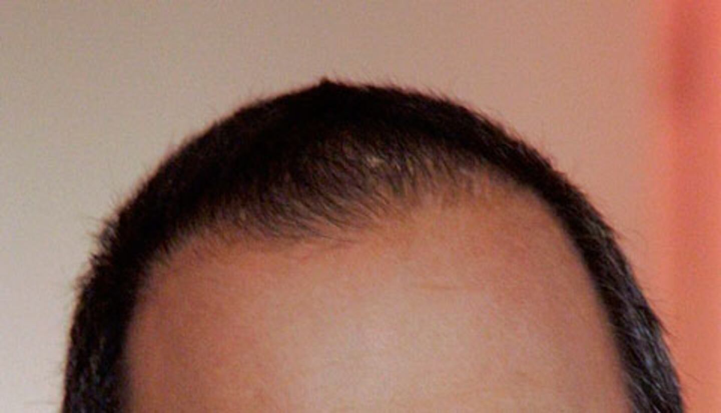 Guess the Stars' Shaved Head