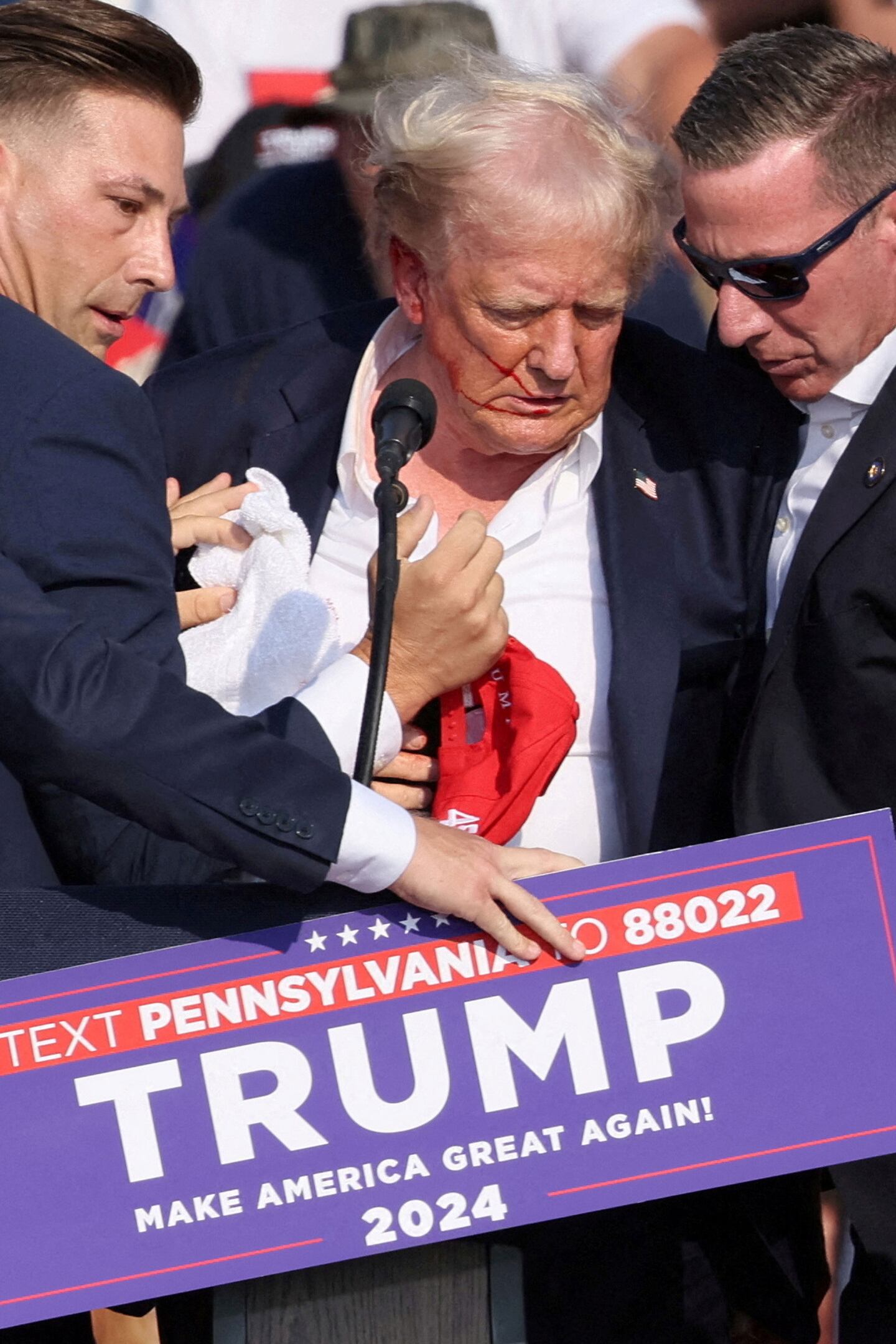 Does Gun Victim Donald Trump Have PTSD? ‘Changes You Mentally’