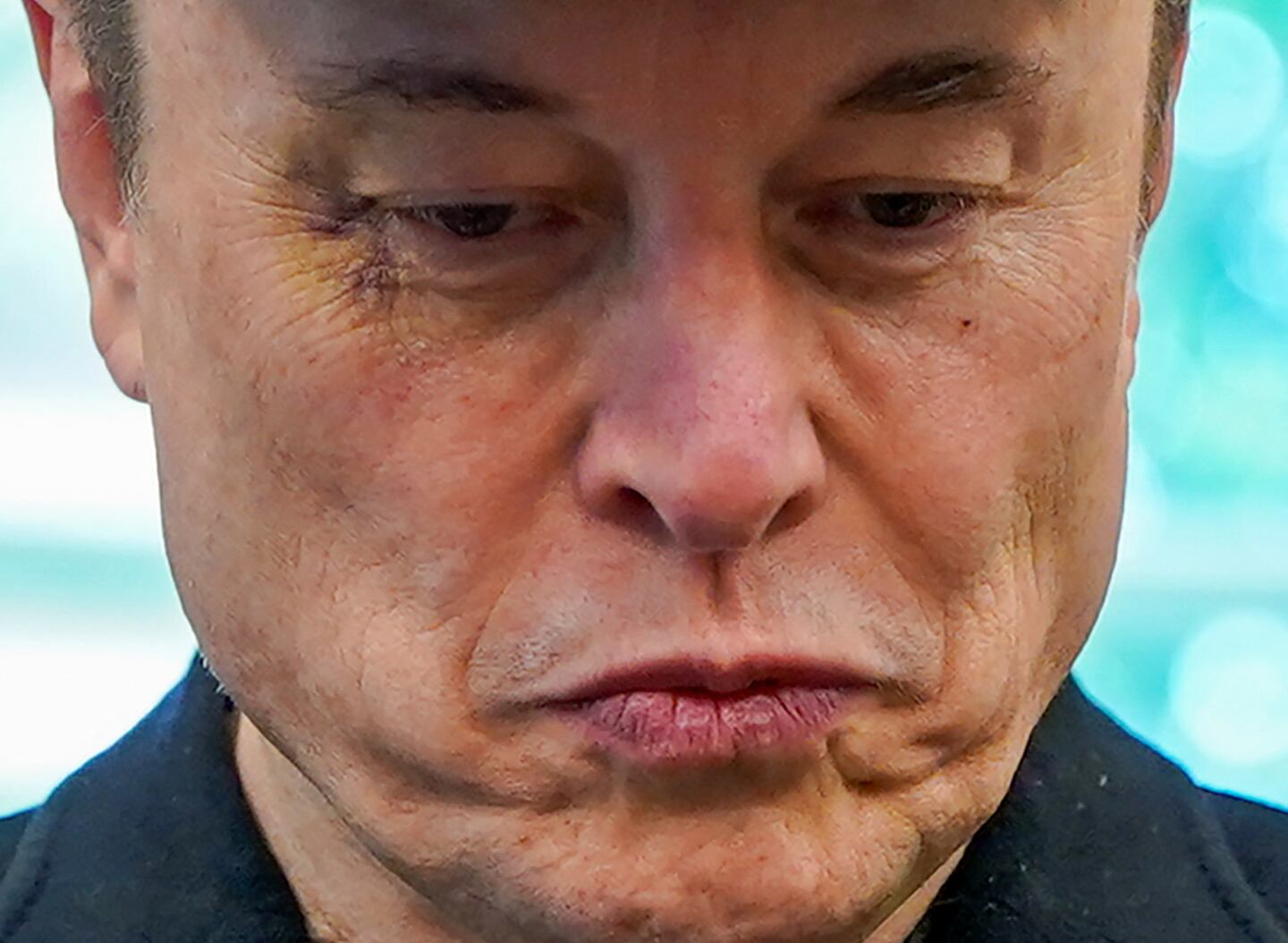 Scott Bessent Addresses Elon Musk’s Mysterious Black Eye After Their ...