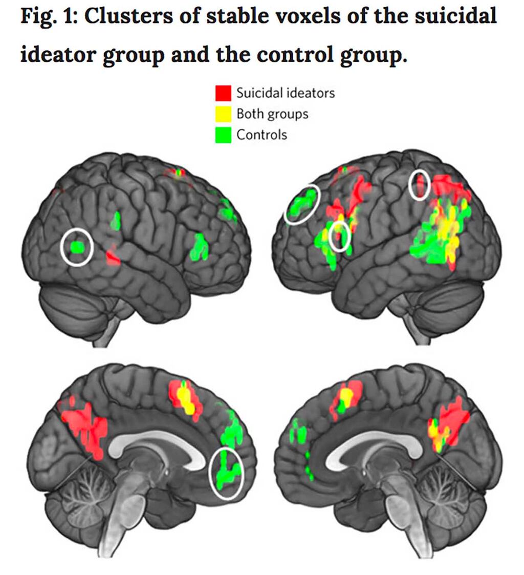 A Machine Might Just Read Your Mind And Predict If Youre Suicidal