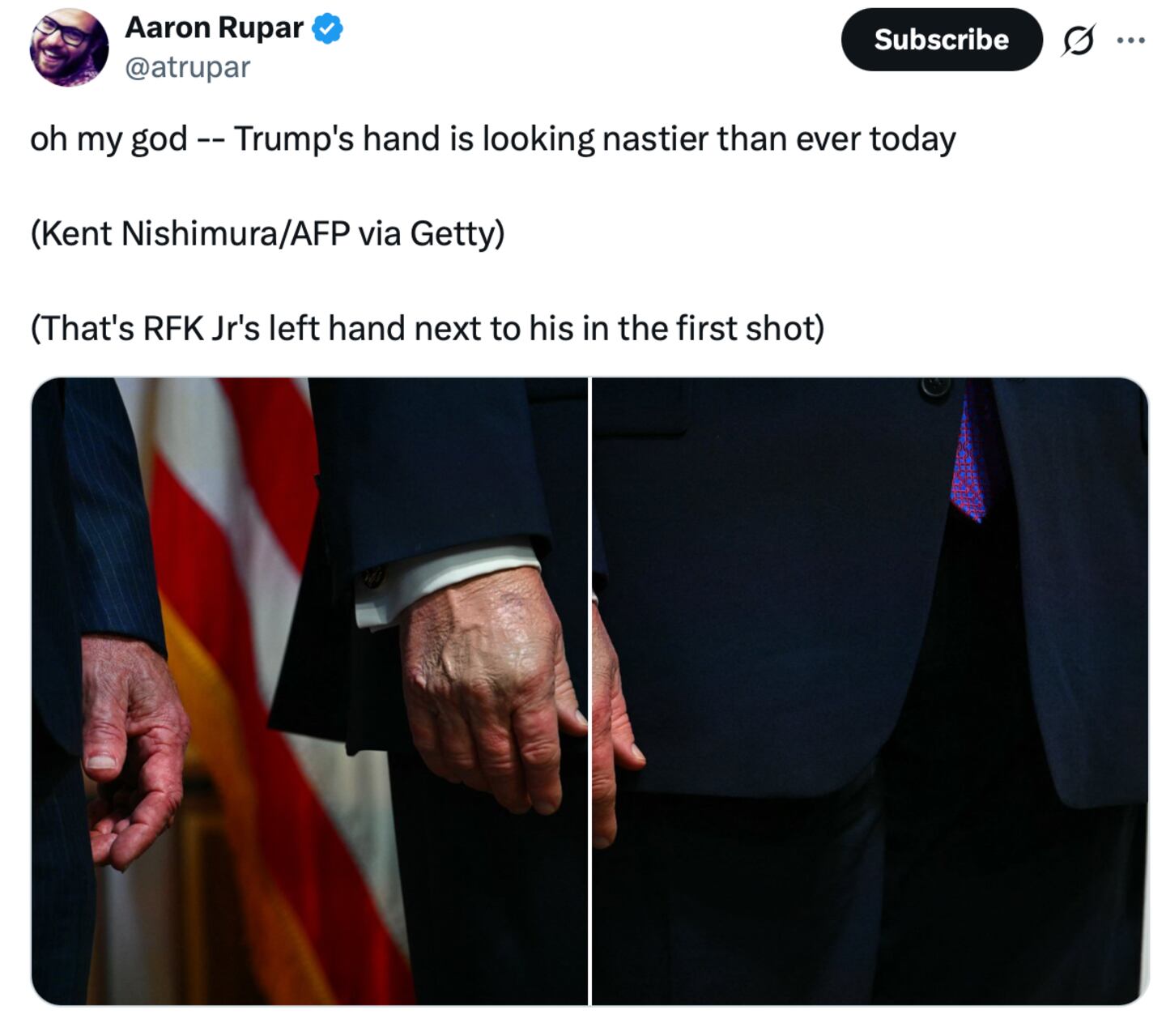 MAGA Goon Robert F. Kennedy Jr., 72, Debuts Gnarly Hand Alongside ...