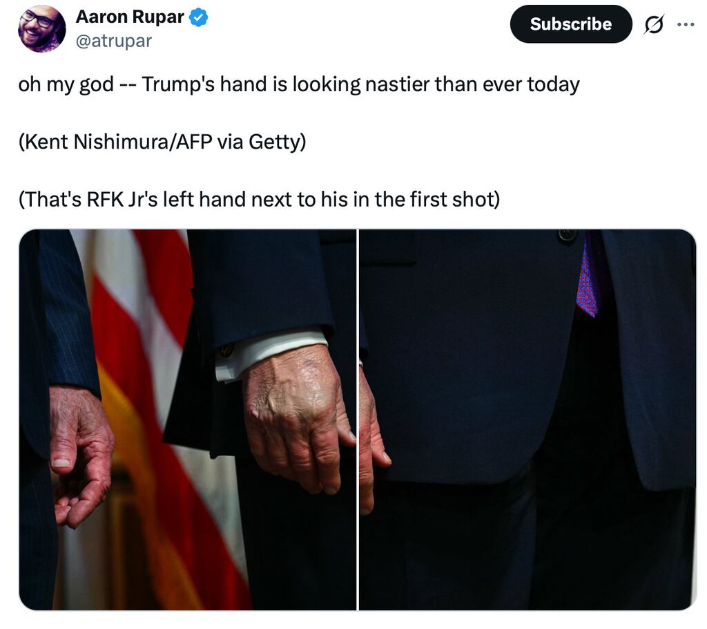 MAGA Goon Robert F. Kennedy Jr., 72, Debuts Gnarly Hand Alongside ...