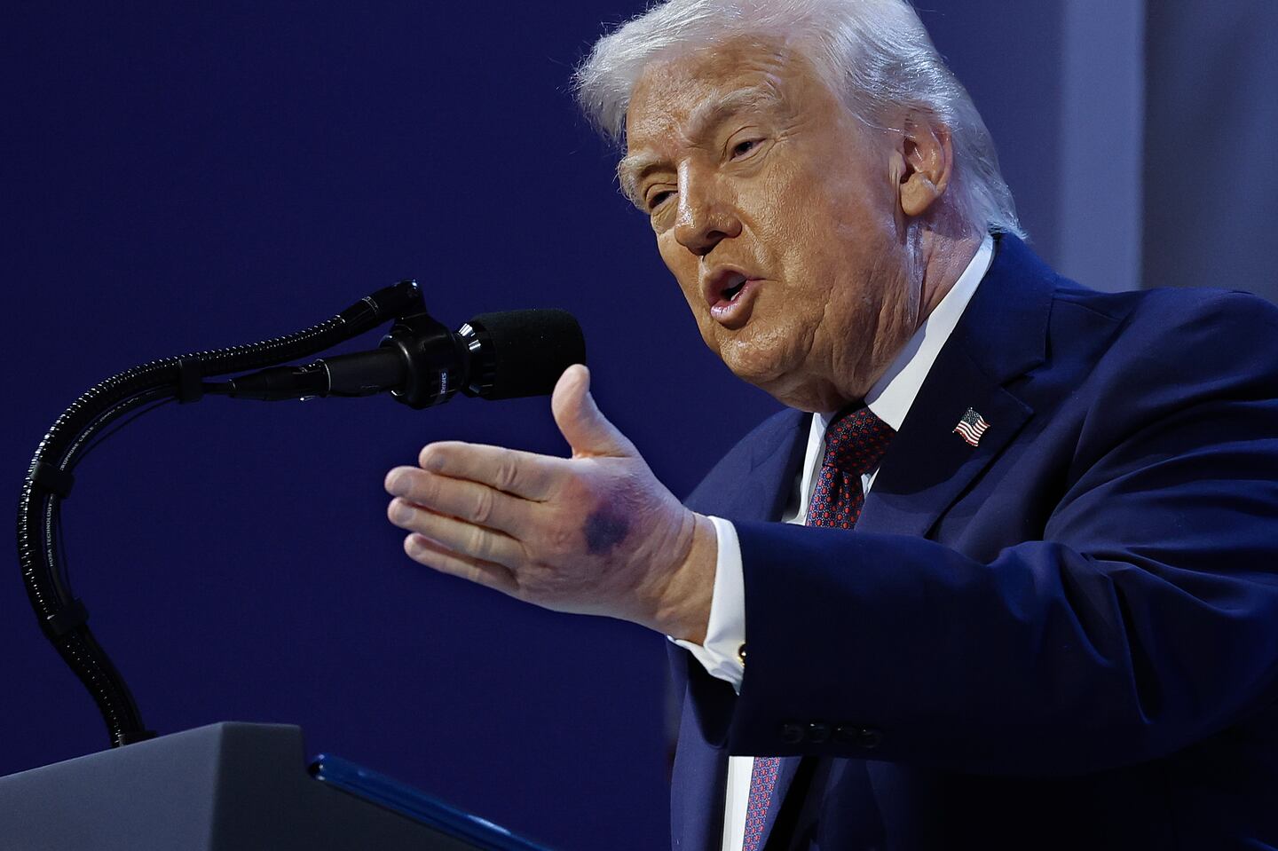 Trump’s Bulging Cankles Exposed by Podcaster