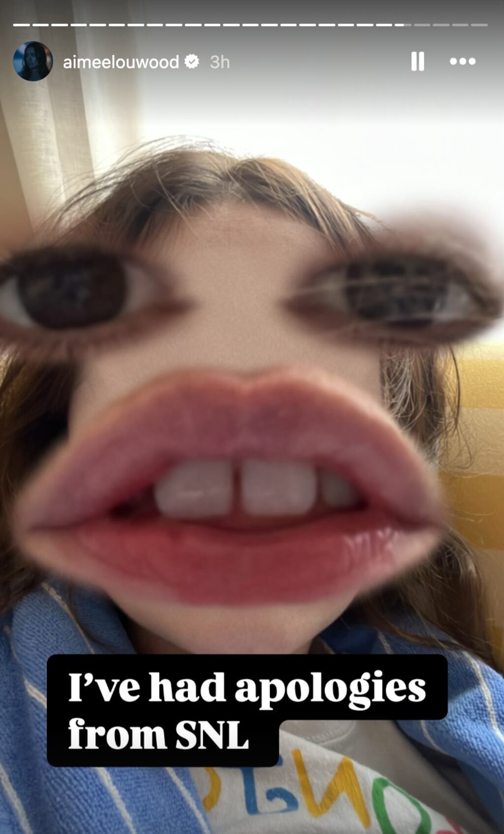 ‘White Lotus’ Star Aimee Lou Wood Goes on Posting Spree After Crying ...