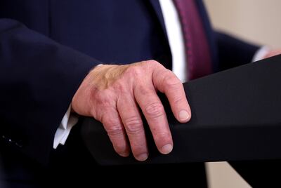Donald Trump, 79, Slathers Bruised Hand With Mismatched Makeup for ...