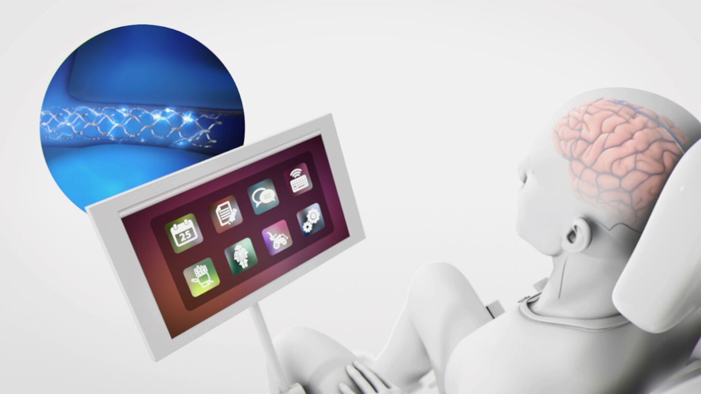 This New Brain-Computer Interface From Synchron Goes Through Your Chest