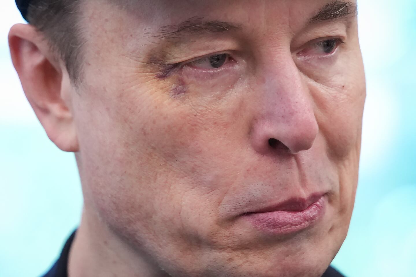 Musk Gives Crazy Explanation for Sporting Black Eye in Oval Office with ...