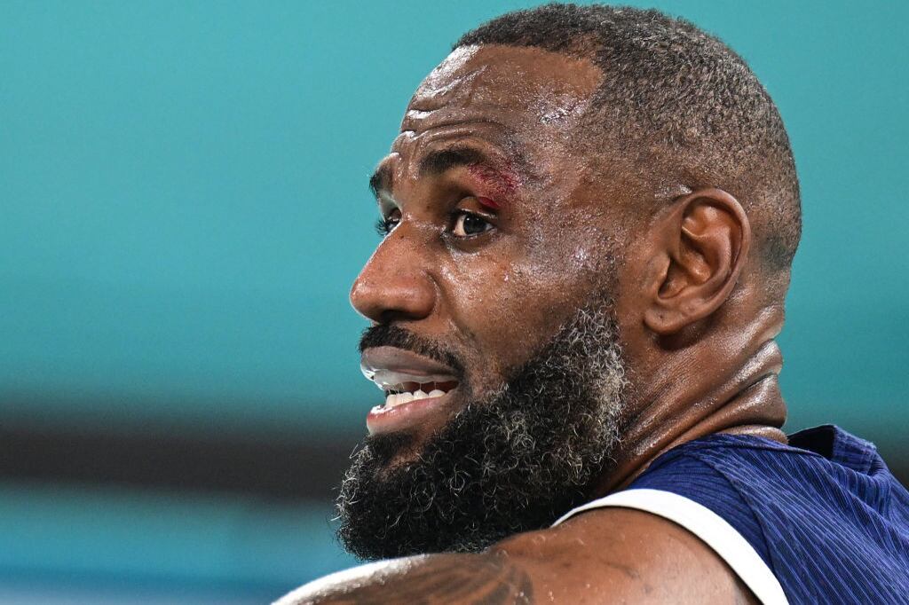 LeBron Needed Four Stitches After Being Elbowed in Head at the Olympics