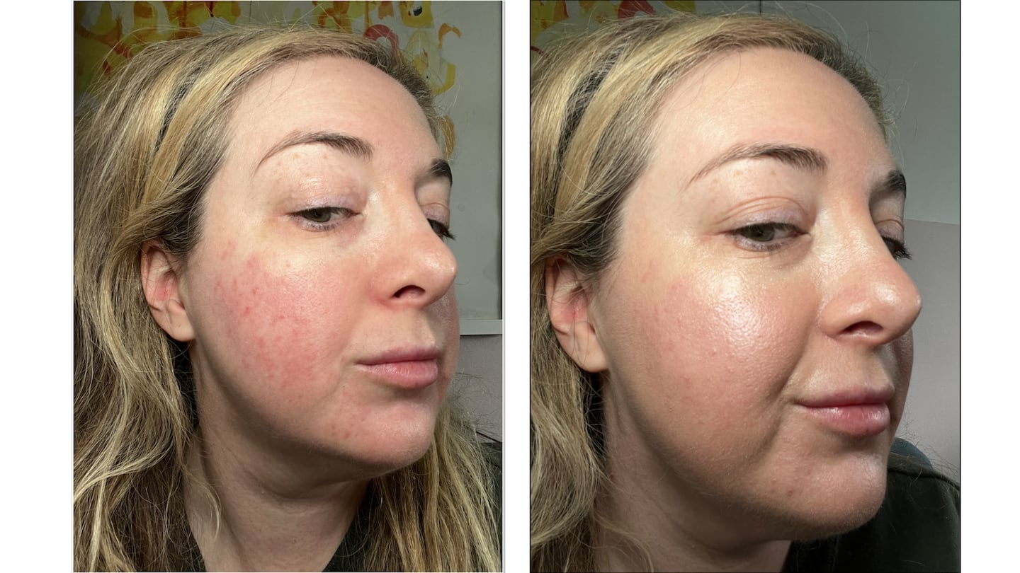 Charlotte Tilbury Flawless Filter Before and After Review 2024