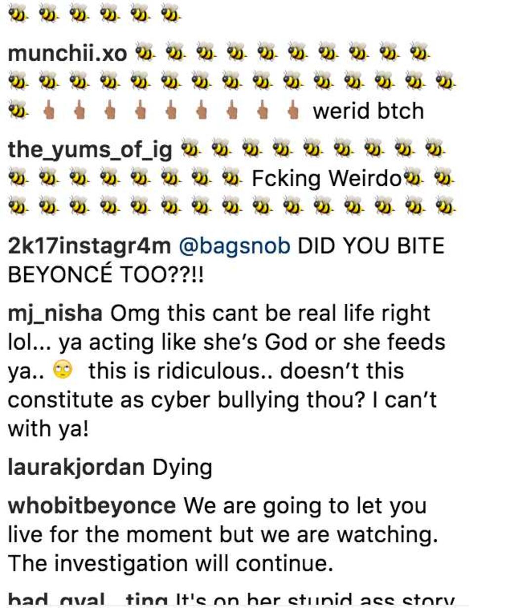 Who Bit Beyoncé? Everything We Know (And Don’t Know) So Far